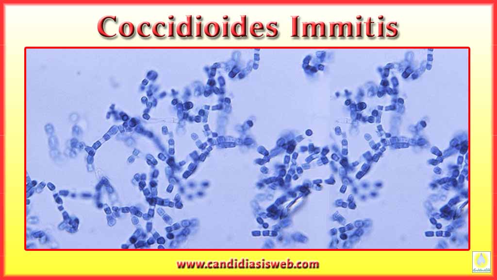 ¿Qué es? - Coccidioides immitis