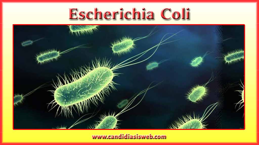 ¿Qué es? - Escherichia coli