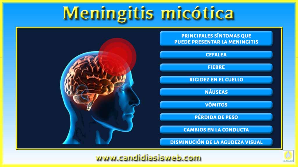 Enfermedades por hongos - Meningitis Micótica Enfermedades por hongos - Meningitis Micótica