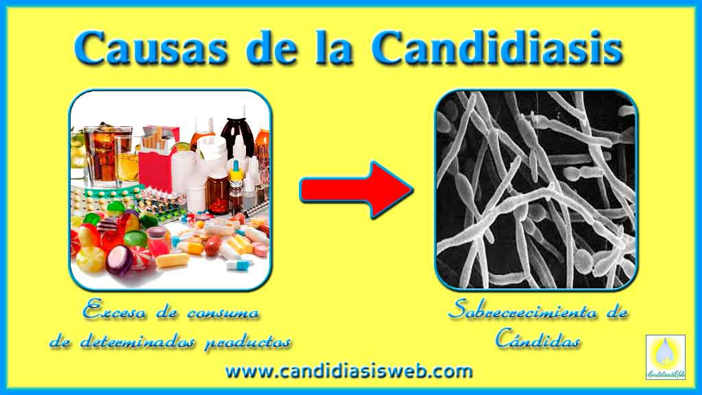 Causas de la Candidiasis
