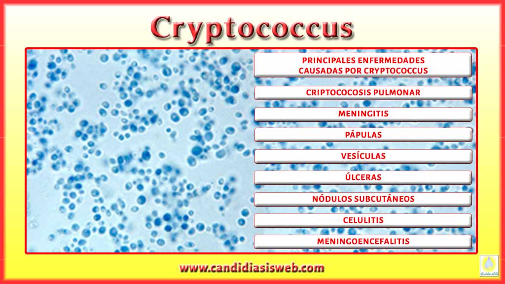 ¿Qué es? - Cryptococcus