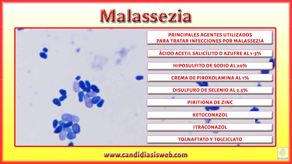 ¿Qué es? - Malassezia