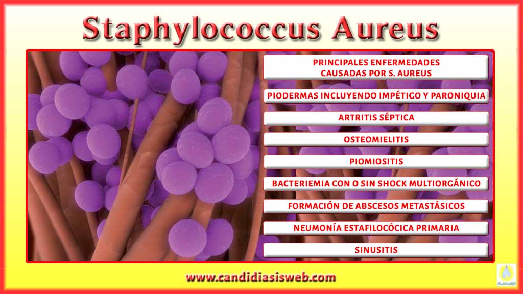 ¿Qué es? - Staphylococcus Aureus