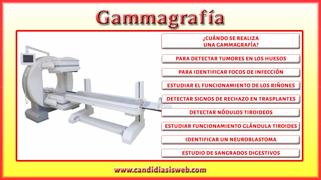 Pruebas y Examenes - Gammagrafía