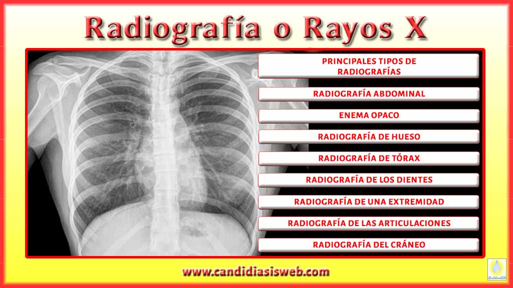 Pruebas y Examenes - Radiografía o Rayos X