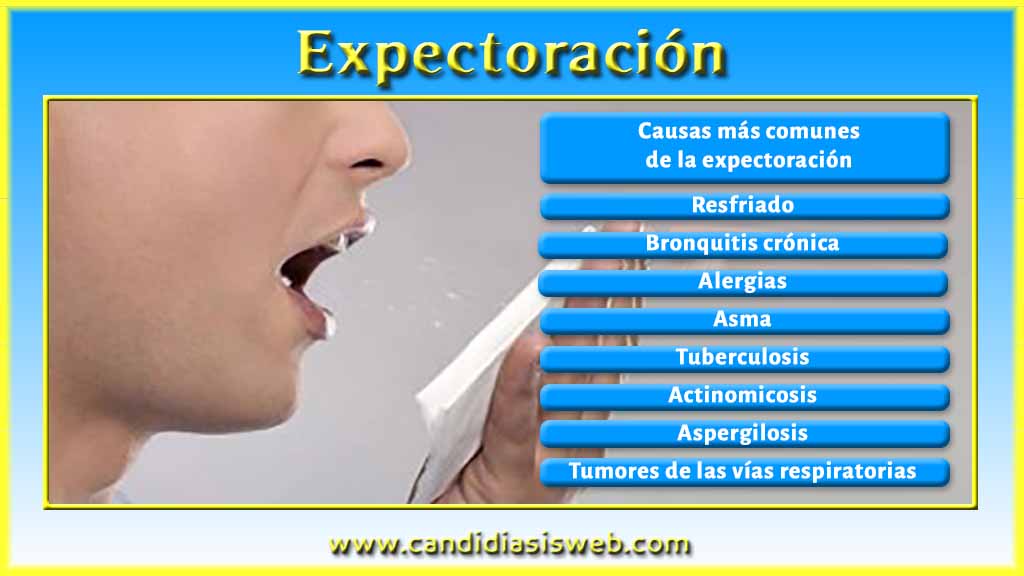 Otros Síntomas - Expectoración