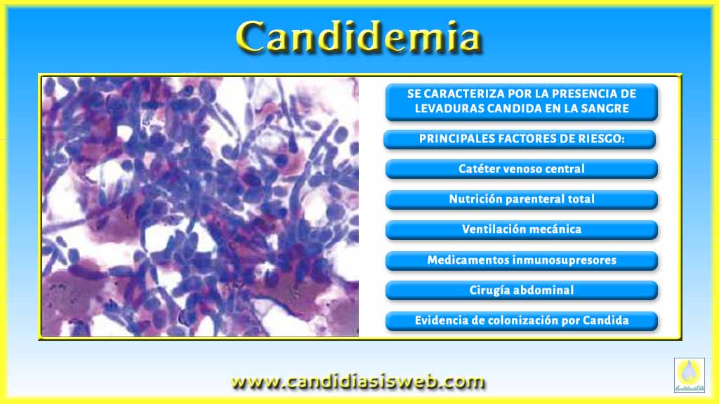 Candidiasis Invasivas - Candidemia