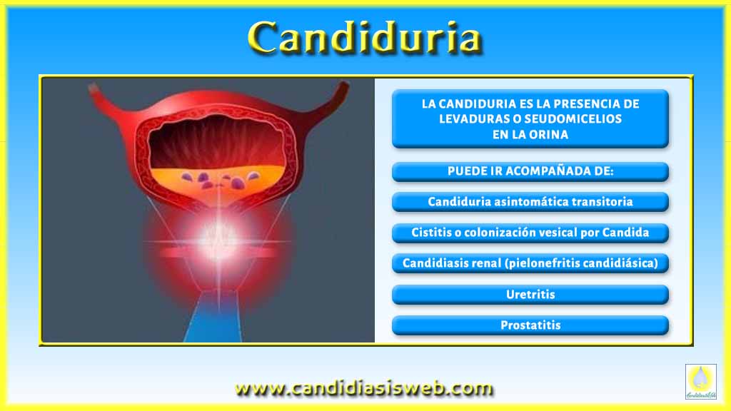 Candidiasis mucocutáneas - Candiduria